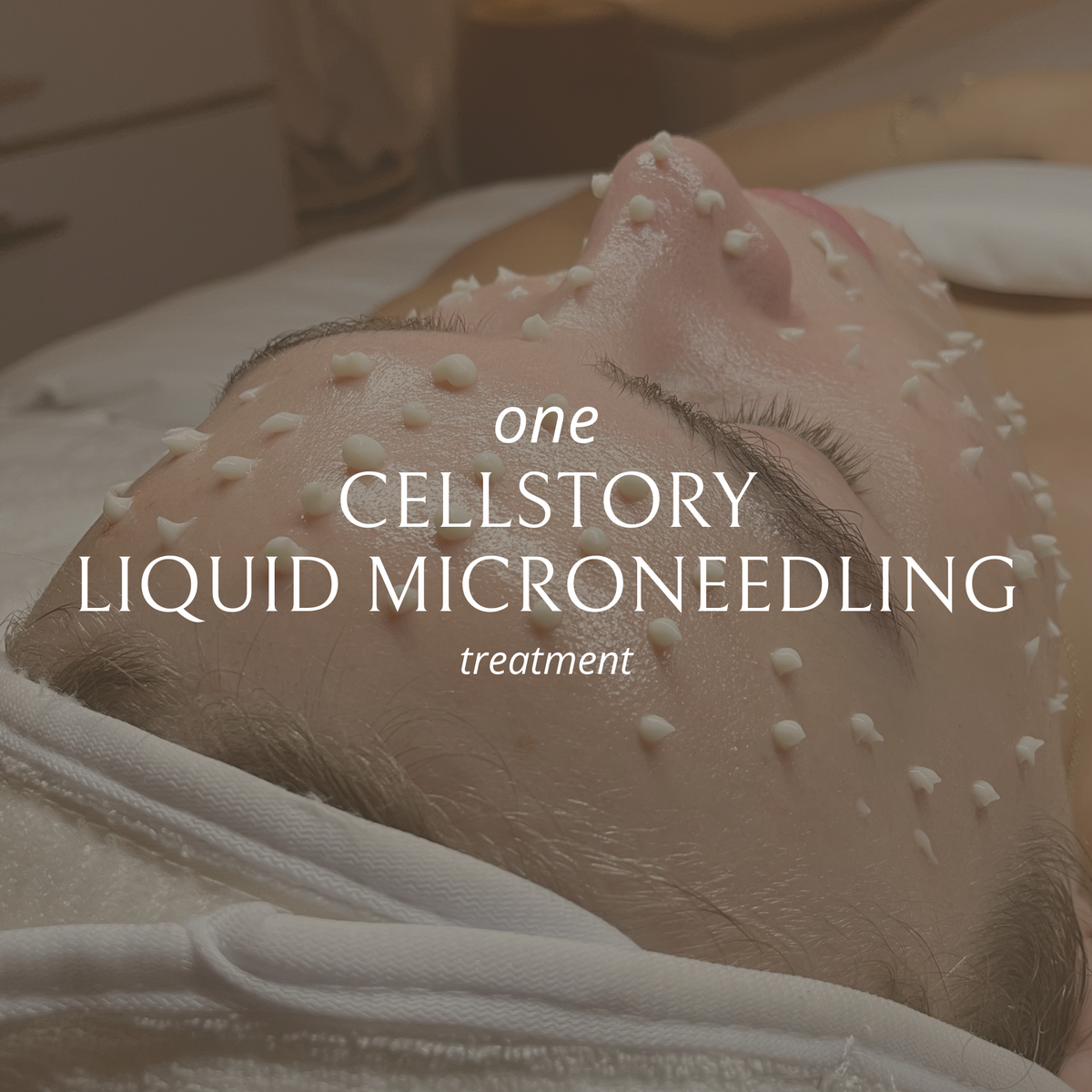 1 Cellstory Liquid Microneedling | Skin Revival Studio